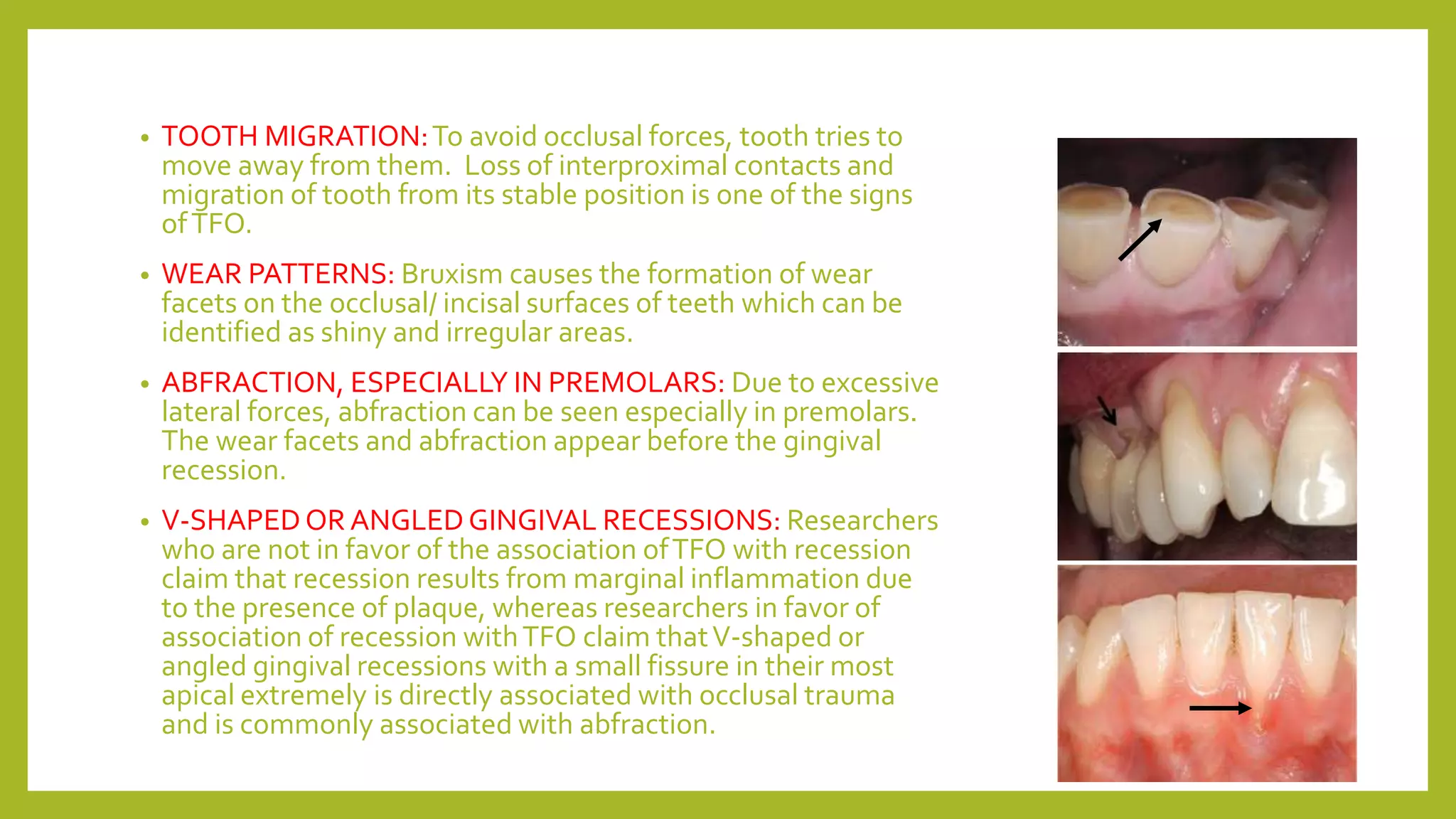Trauma from occlusion in periodontics | PPTX