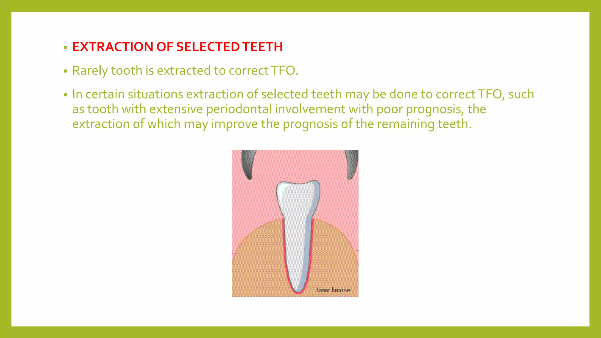 Trauma from occlusion in periodontics | PPTX | Oral care | Personal Care
