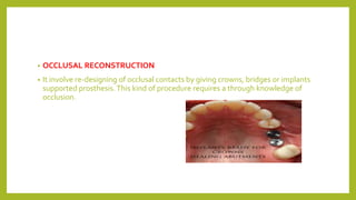 Trauma from occlusion in periodontics | PPTX