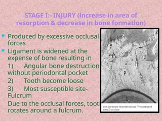 trauma_from_occlusion__perio_.pptx sneha | PPTX