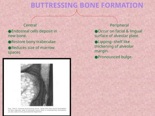 trauma_from_occlusion__perio_.pptx sneha | PPTX