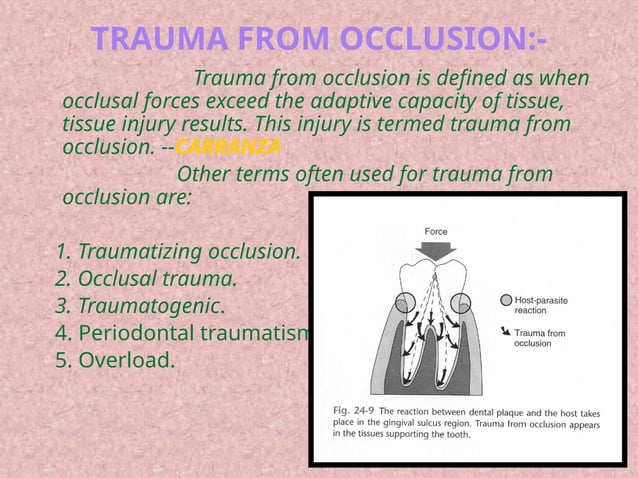 trauma_from_occlusion__perio_.pptx sneha | PPT