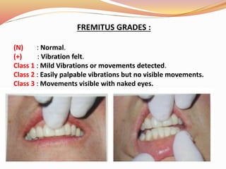 Trauma from occlusion. | PPTX