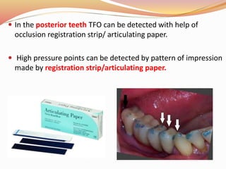 Trauma from occlusion. | PPTX