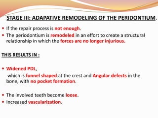 Trauma from occlusion. | PPTX