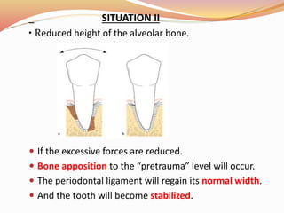 Trauma from occlusion. | PPTX