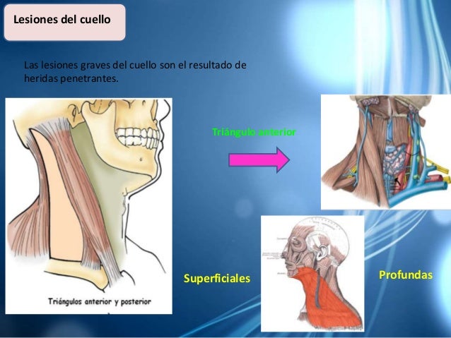 Trauma general y cuello