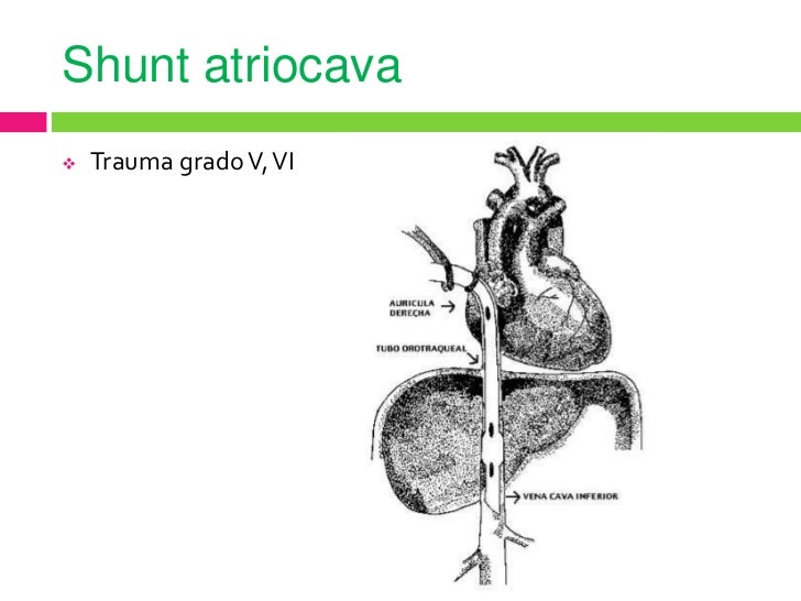 Trauma hepatico