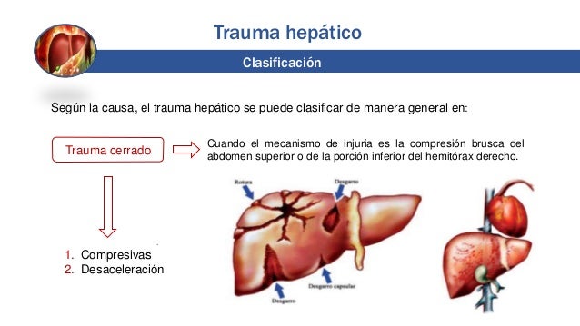 Trauma hepático