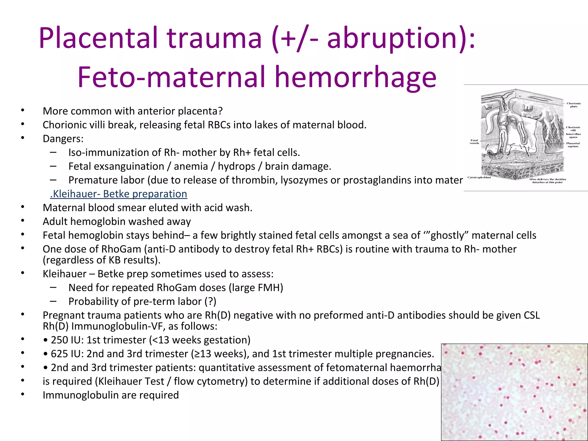 Trauma in pregnancy | PPT