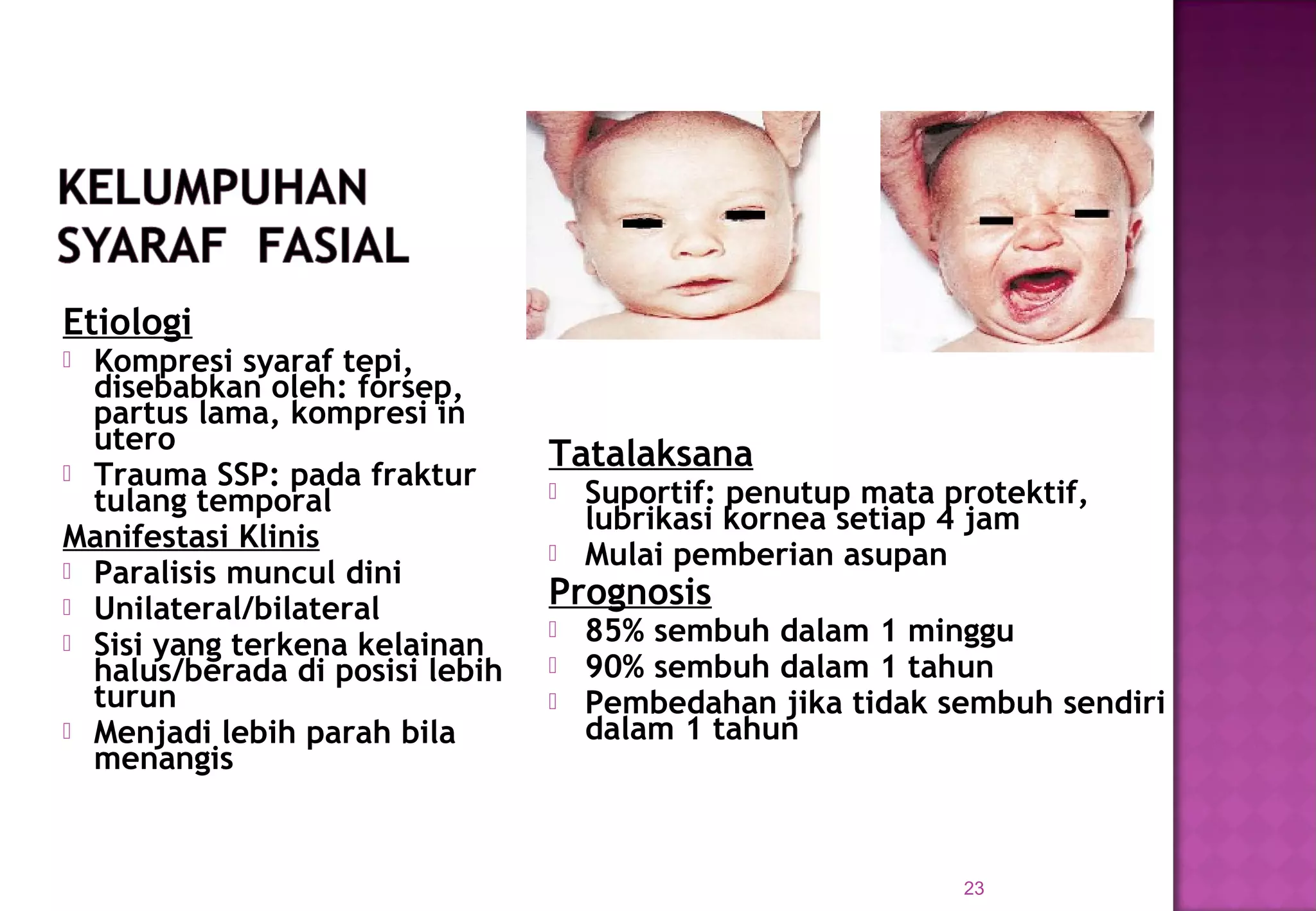Trauma lahir gds k15 | PPT