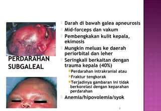 Trauma lahir gds k15 | PPT