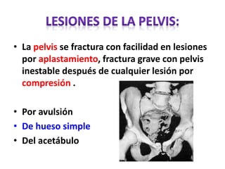 Trauma lesiones de la pelvis | PPTX
