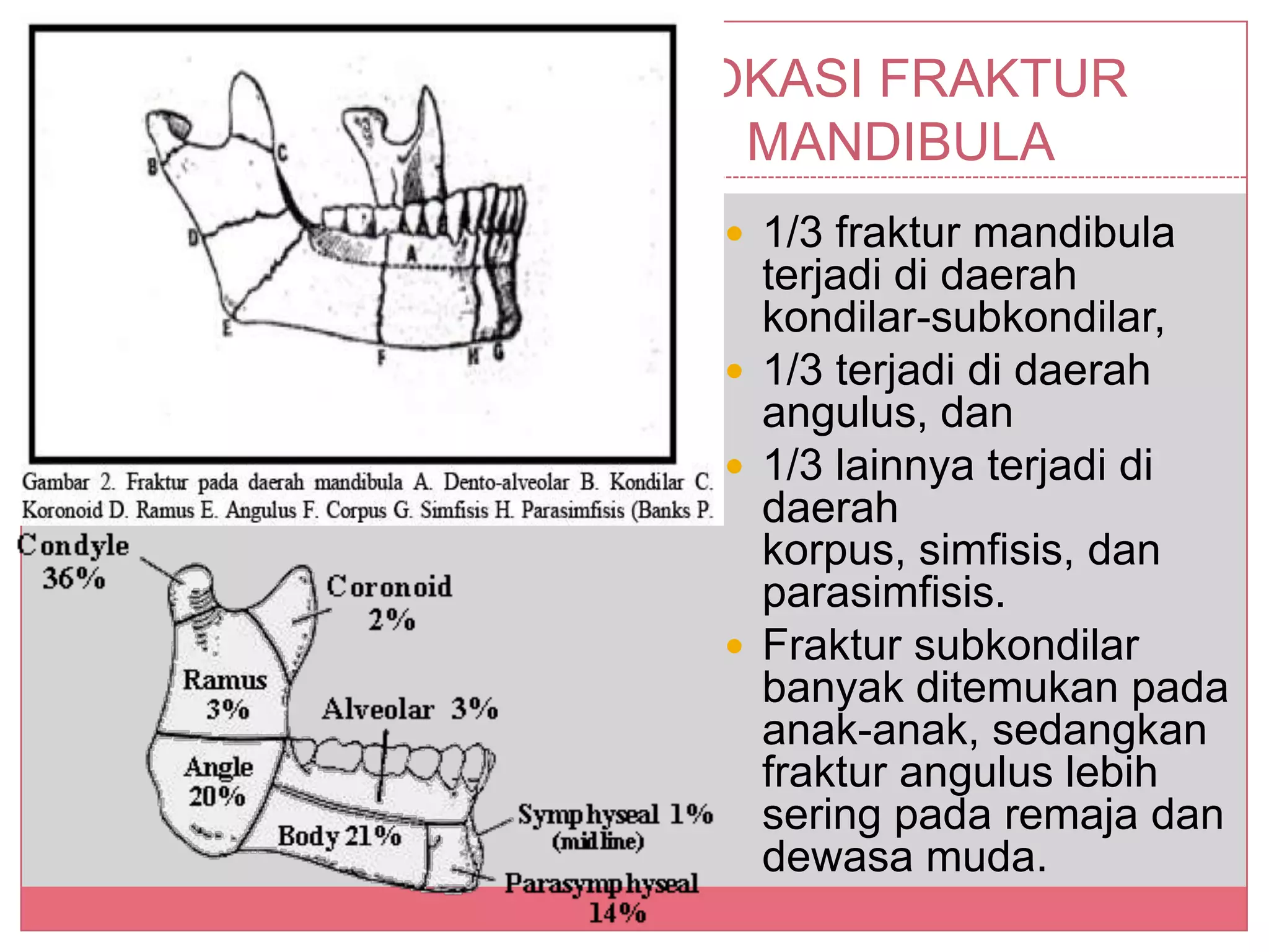 Trauma maksilofasial | PPTX