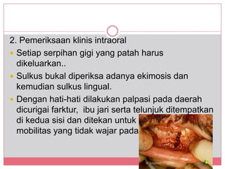 Trauma maksilofasial | PPTX