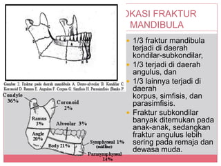 Trauma maksilofasial | PPT