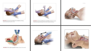 TRAUMA MANAGEMENT IN A MINOR TRAUMA UNIT.pptx