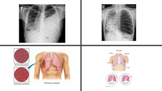 TRAUMA MANAGEMENT IN A MINOR TRAUMA UNIT.pptx