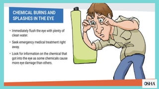 Trauma Mata_Seminar, cedera, luka, yang terjadi pada mata | PPTX