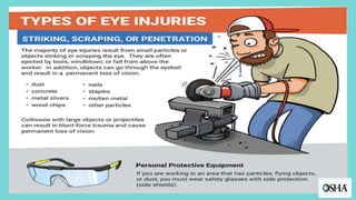 Trauma Mata_Seminar, cedera, luka, yang terjadi pada mata | PPTX