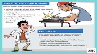 Trauma Mata_Seminar, cedera, luka, yang terjadi pada mata | PPTX