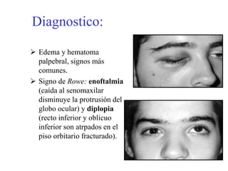 Trauma maxilofacial | PPT
