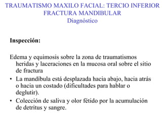 Trauma maxilofacial | PPT