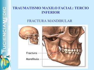 Trauma Maxilofacial Fmh Unprg Tucienciamedic | PPT