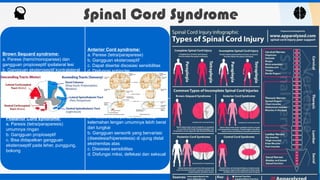 Trauma medula spinalis, Trauma medula spinalis, | PPTX