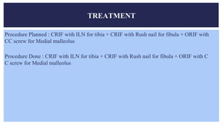 Trauma meet is a good approach (1)-1.pptx