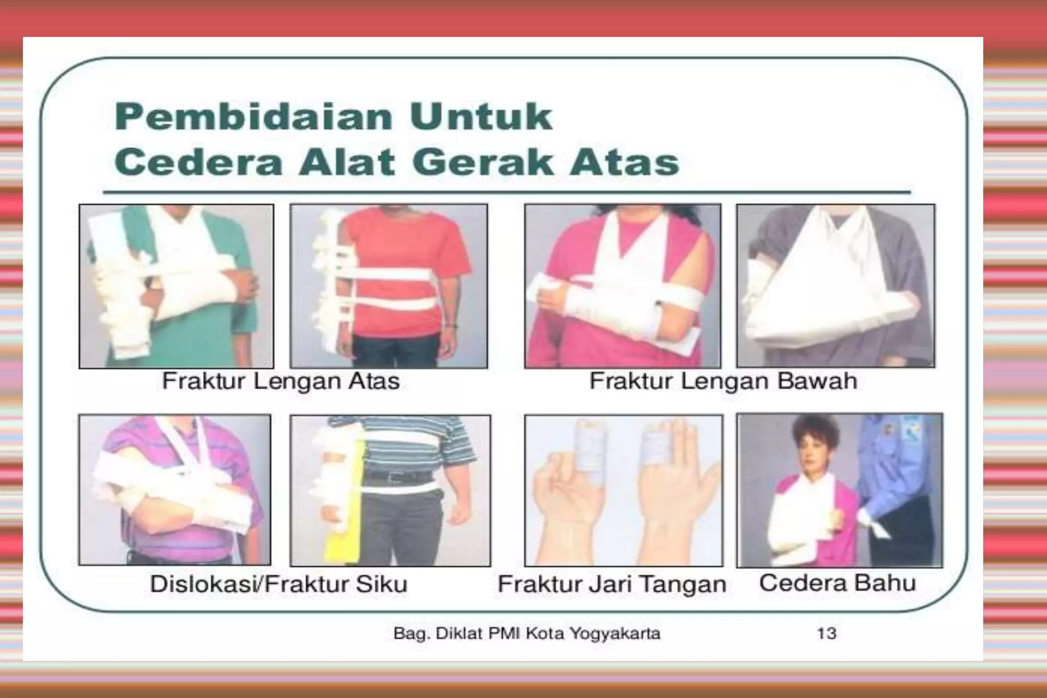 Trauma muskuloskeletal | PPT