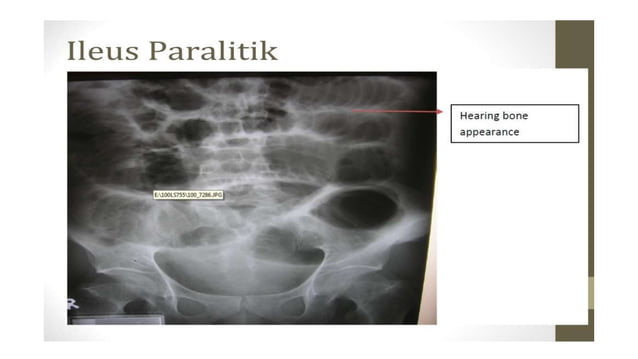 TRAUMA_NONTRAUMA_MEI_2020.pptx