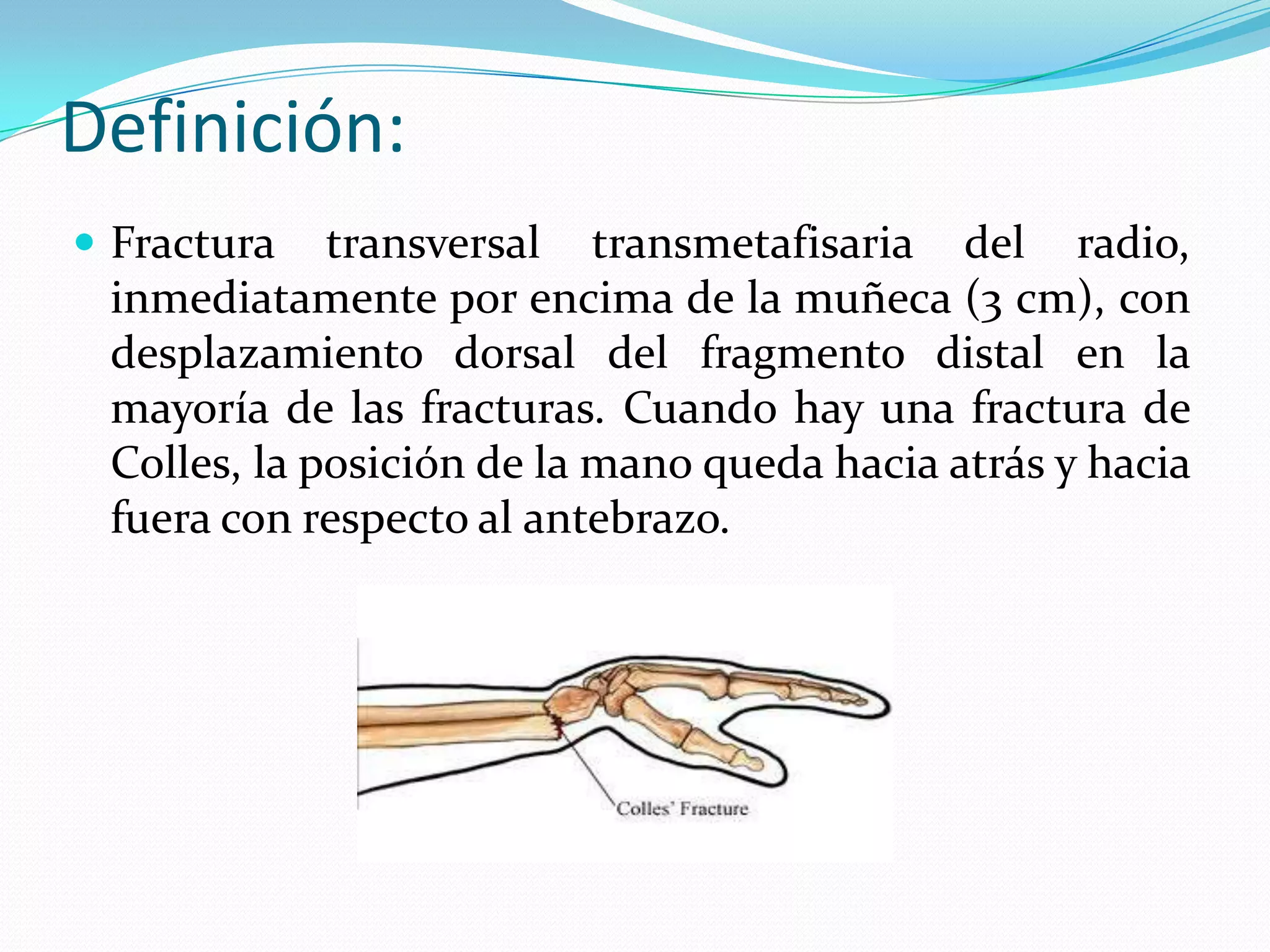 FRACTURA DE POUTEAU COLLES | PPTX