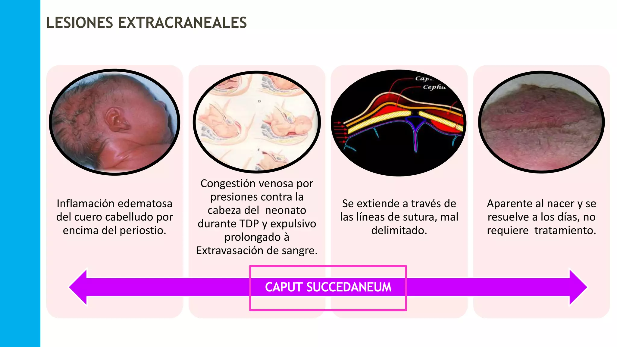 Trauma obstétrico | PPTX