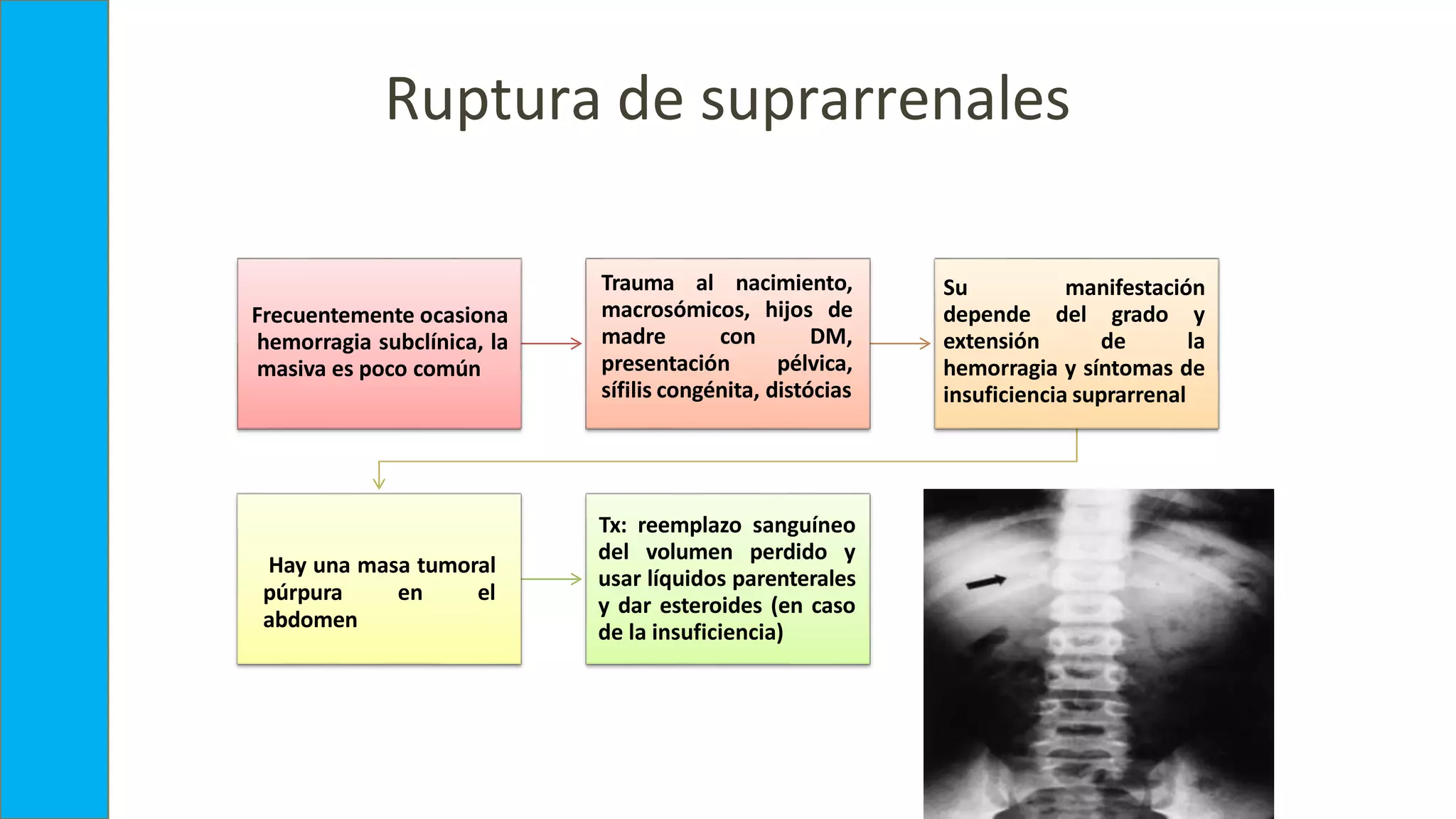 Trauma obstétrico | PPTX