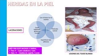 Trauma obstétrico | PPTX