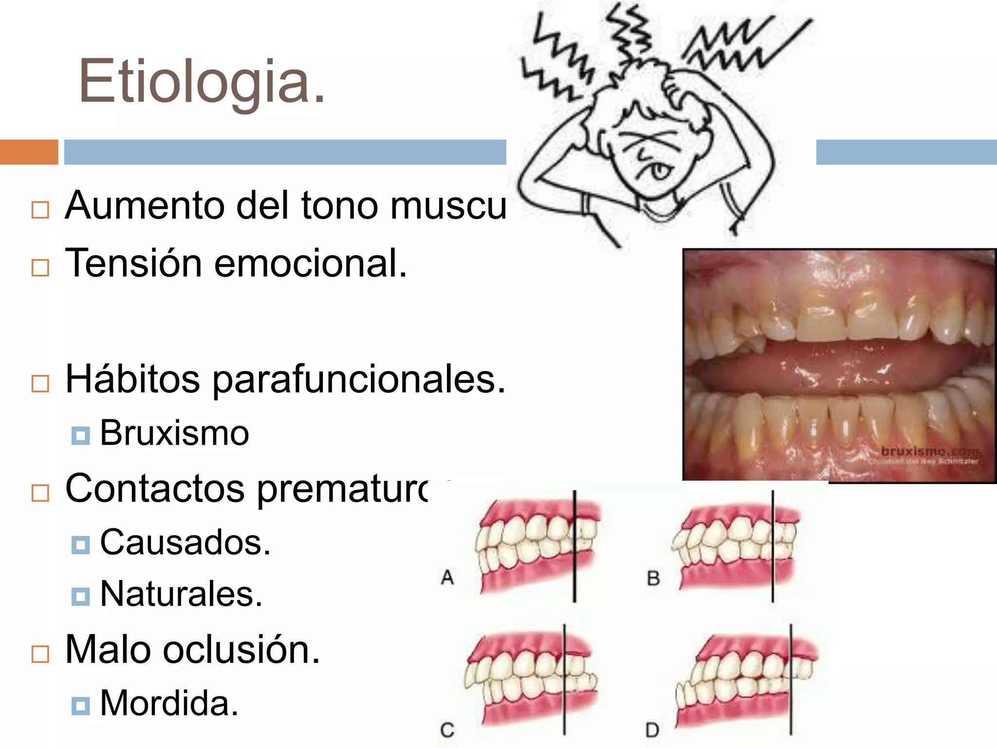 Trauma oclusal | PPTX