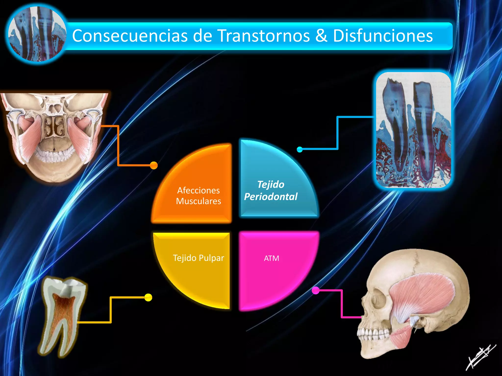 Trauma Oclusal -Terapéutica Periodontal -Germán Alejandro Aguilar ...