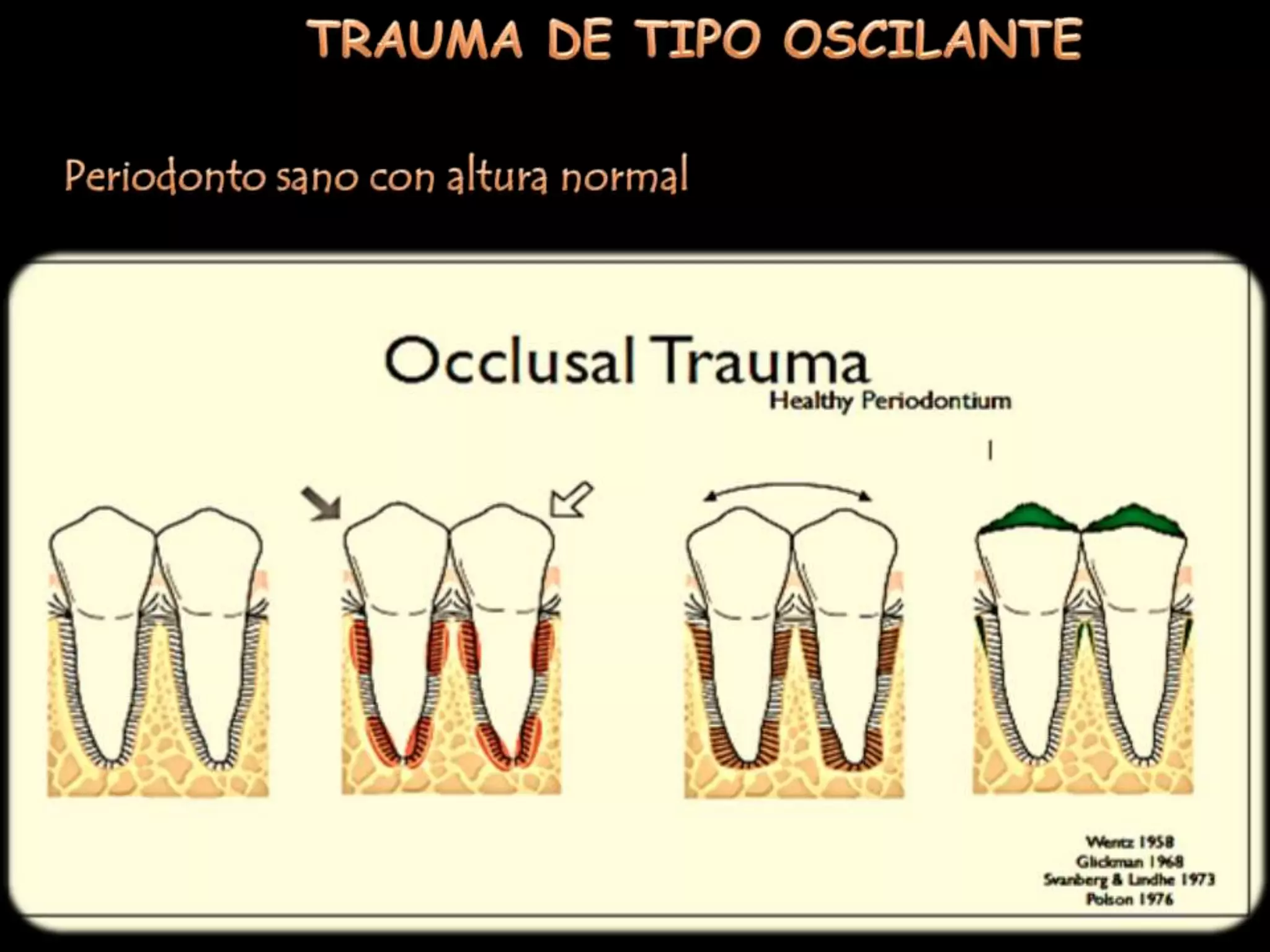 Trauma oclusal orto perio Dr. Nelson Mendoza | PPTX