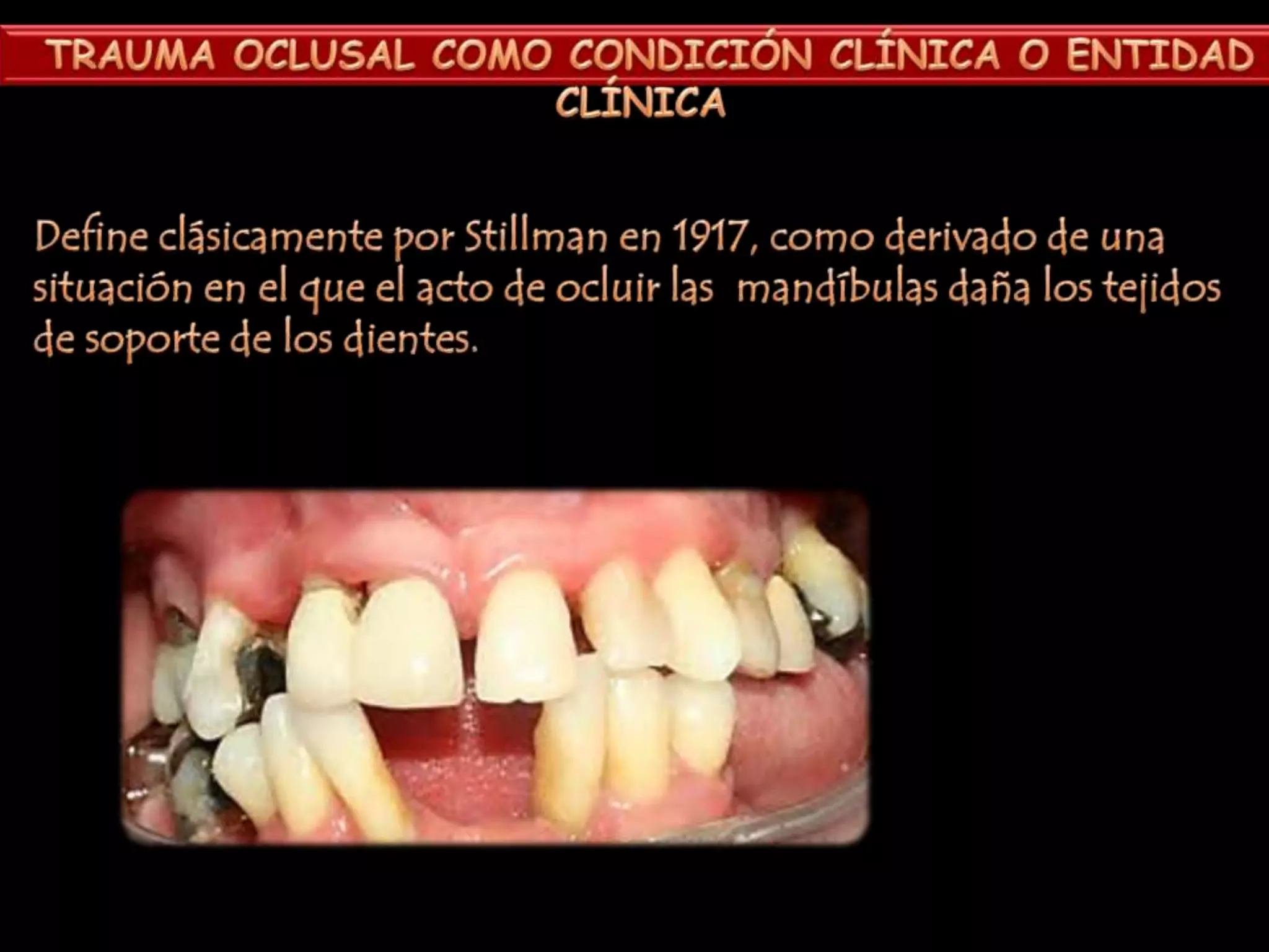 Trauma oclusal orto perio Dr. Nelson Mendoza | PPTX