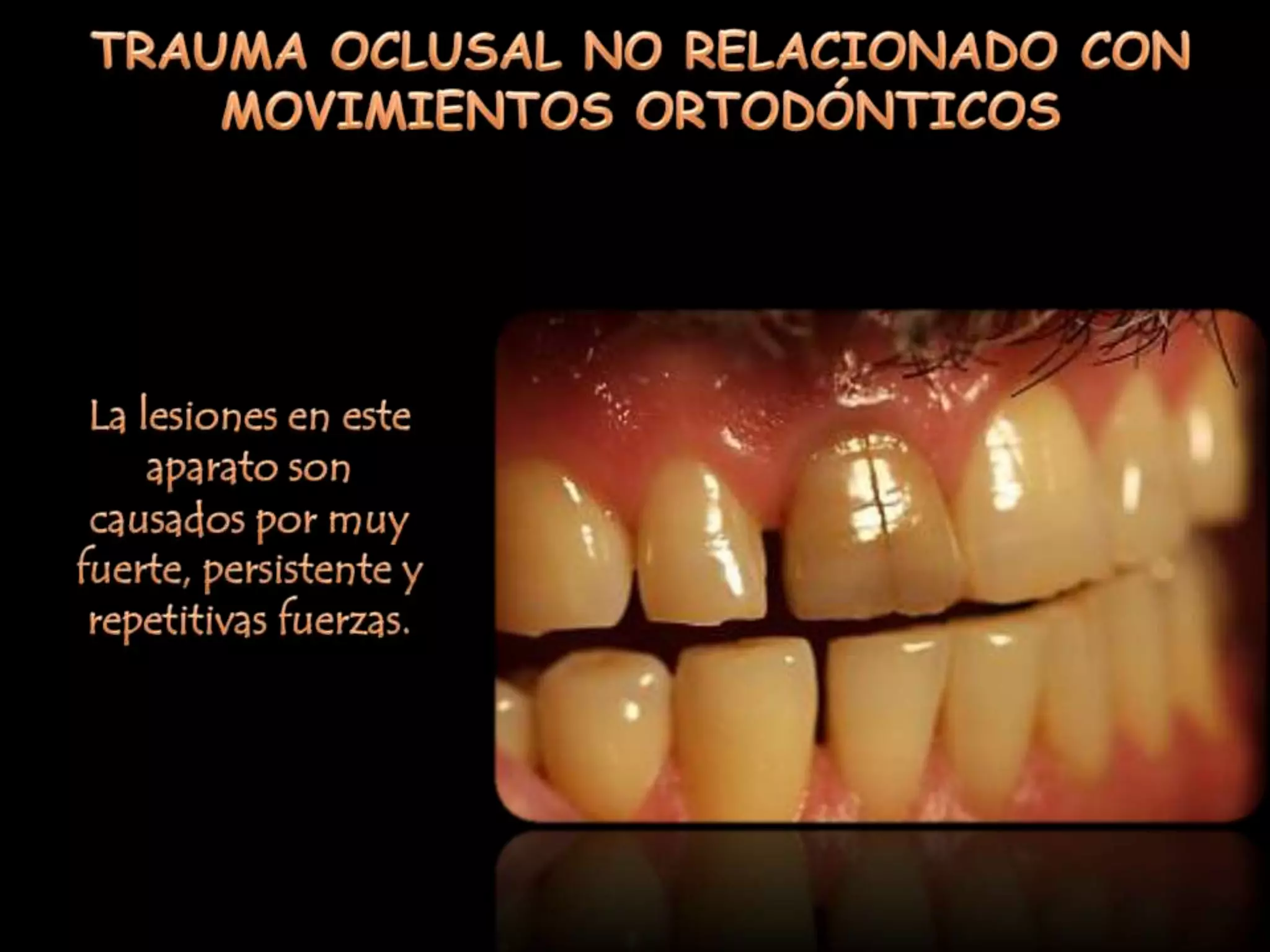 Trauma oclusal orto perio Dr. Nelson Mendoza | PPTX