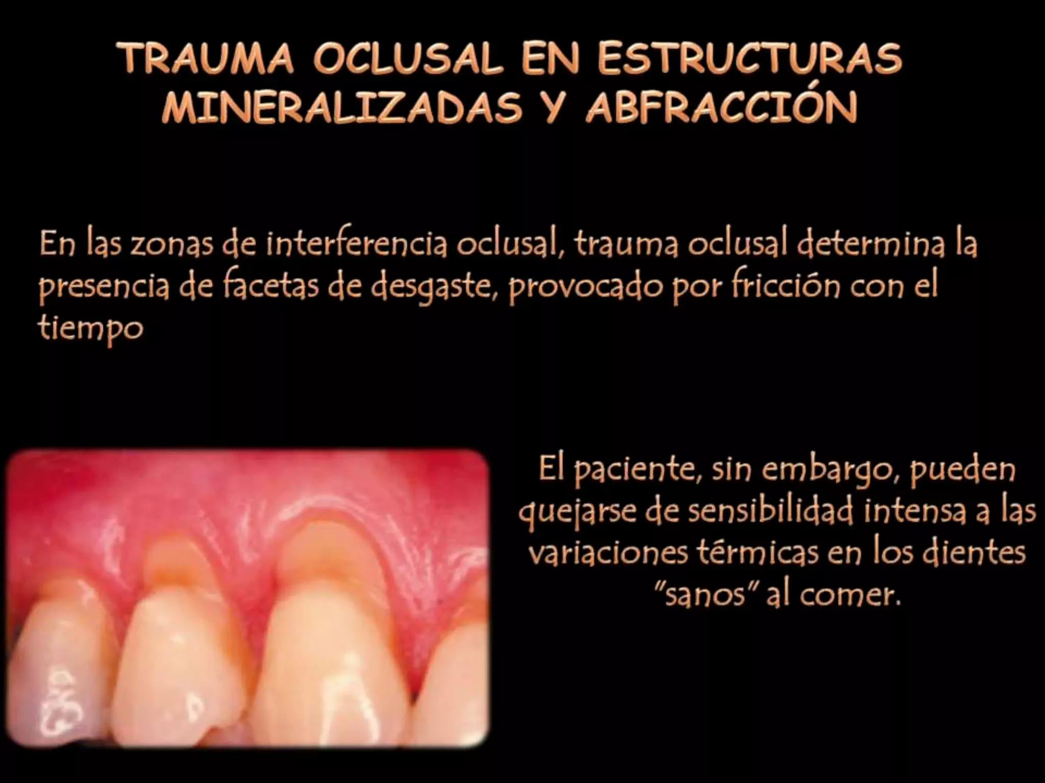 Trauma oclusal orto perio Dr. Nelson Mendoza | PPTX