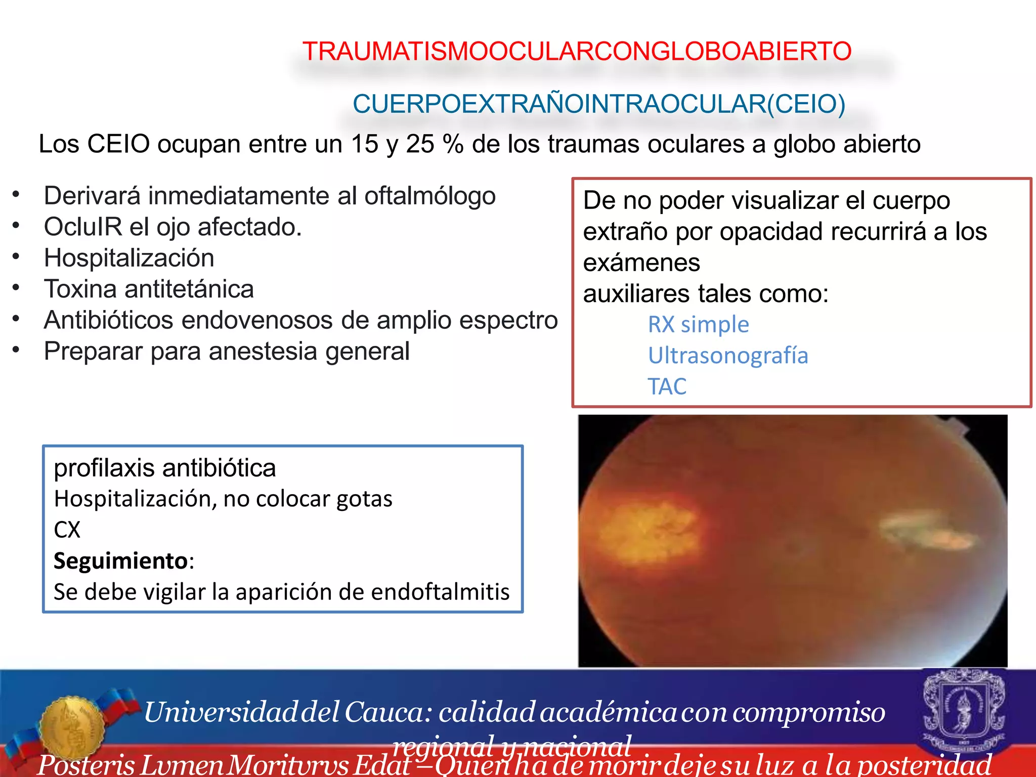 trauma ocular | PPTX