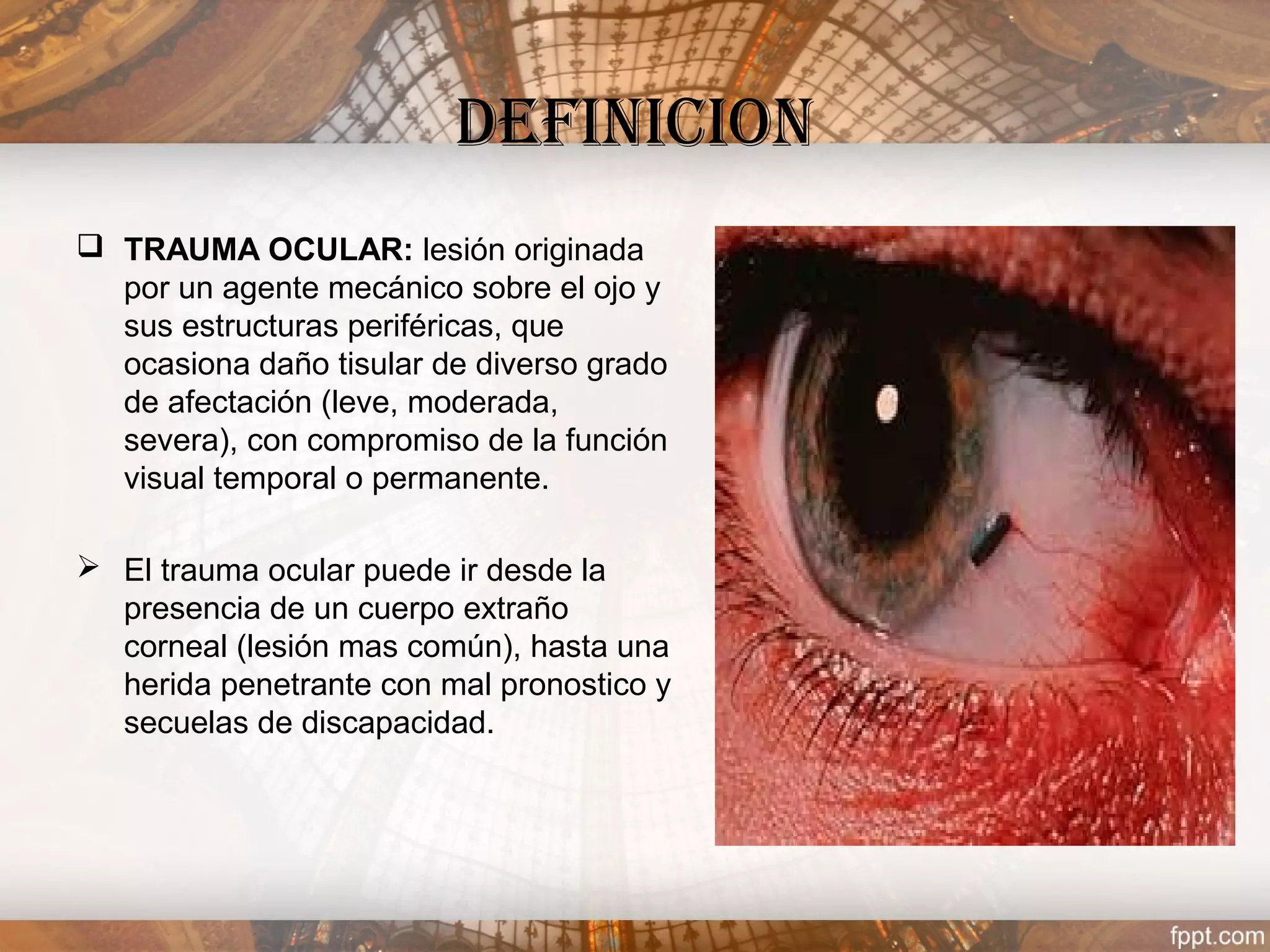 Trauma ocular | PPT