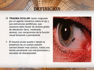 Trauma ocular | PPT