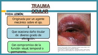 Urgencias oftalmológicas: Trauma ocular. | PPTX