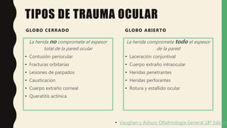 Trauma ocular | PPTX