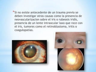 Trauma ocular cerrado | PPTX