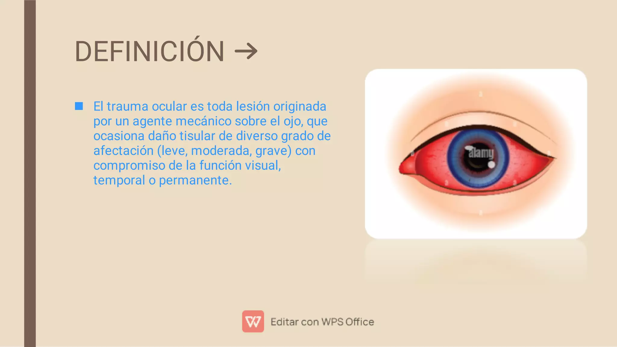 TRAUMA OCULAR EXPO ANGIE.pdf