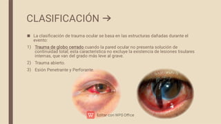 TRAUMA OCULAR EXPO ANGIE.pdf